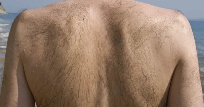 11 Ways to Get Rid of Hairy Back - Ulike