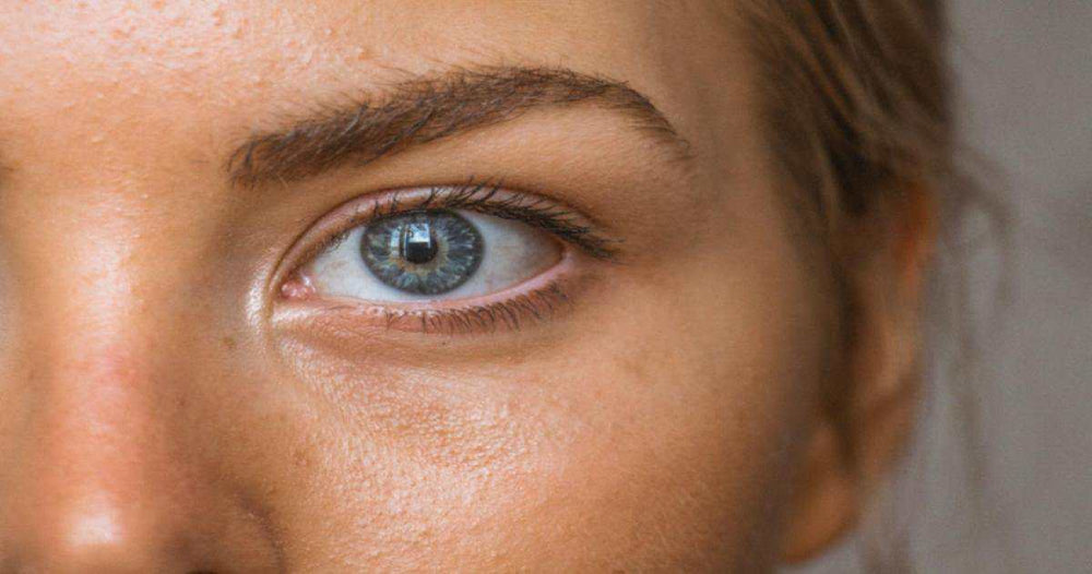 Hives After Waxing Causes, Treatment, and Prevention - Ulike