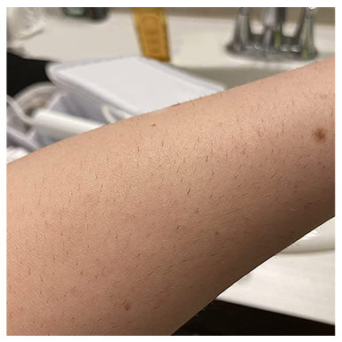 Ulike IPL Devices | Laser Hair Removal at Home