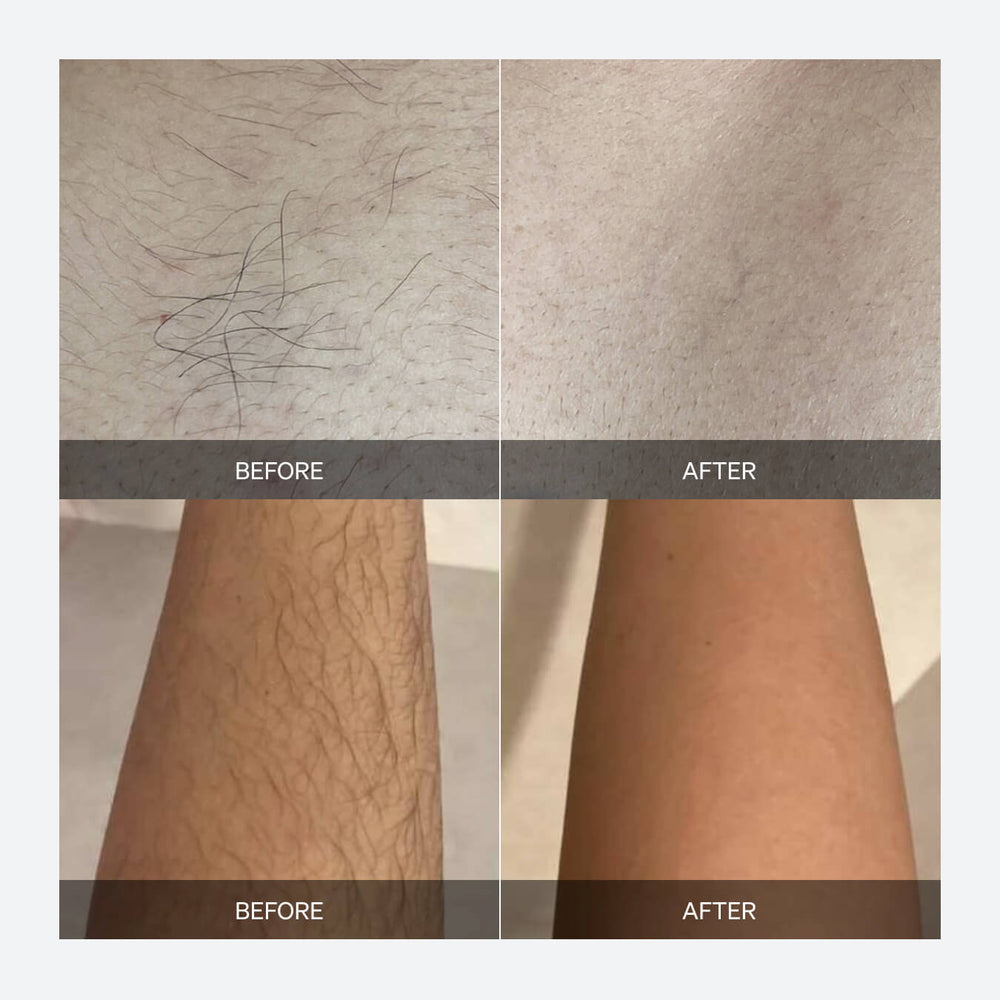 Ulike Sapphire Air+ IPL Hair Removal Handset